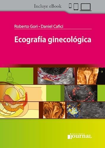 Ecografía Ginecológica: Gori, Roberto/ CAFICI, DANIEL: 9789878452562 ...