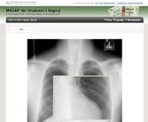 MKSAP for Student 5 Digital: 9781934465967: Medicine & Health Science ...