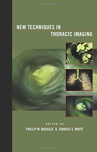 New Techniques in Thoracic Imaging: White, Charles: 9780824706401 ...
