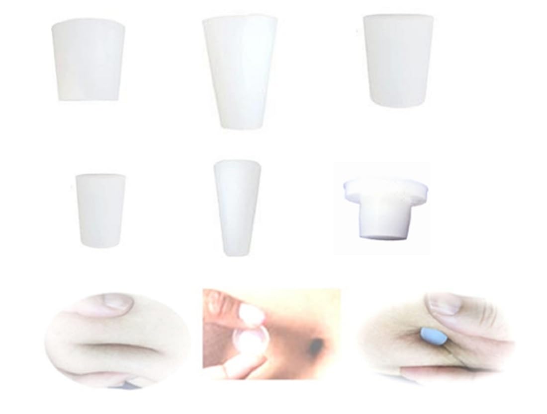 Buy GenericBelly Button Plug Stopper Tummy Tuck Navel Shaper after Lipo ...