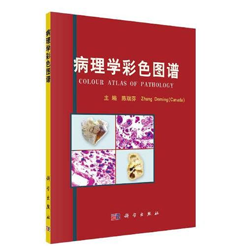 Amazon.com: Color Atlas of Pathology: 9787030169808: CHEN RUI FEN: Books