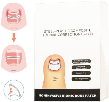 Amazon.com: Titanium Alloy Silicone Ingrown Toenail Treatment, Designed ...