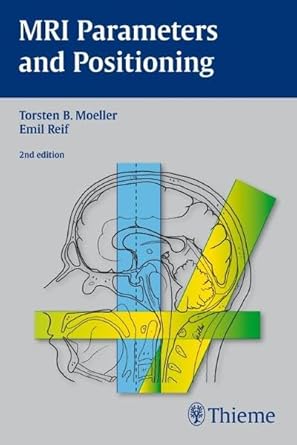 MRI Parameters and Positioning: 9783131305824: Medicine & Health ...