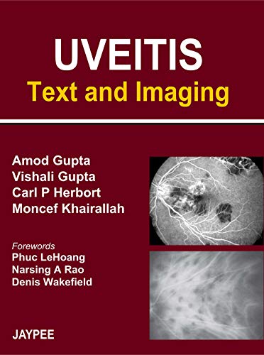 Uveitis: Text and Imaging eBook : Gupta, Amod, Gupta, Vishali, Harbort ...