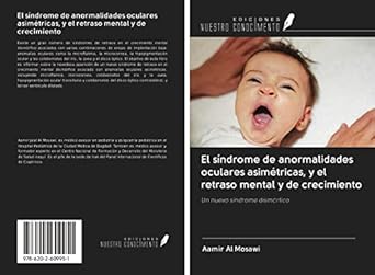 El síndrome de anormalidades oculares asimétricas, y el retraso mental ...