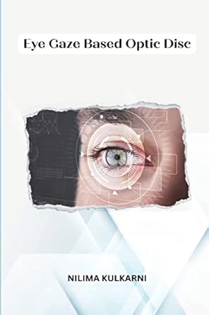 Buy Eye Gaze Based Optic Dis Book Online at Low Prices in India | Eye Gaze Based Optic Dis ...
