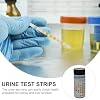 ULTECHNOVO 100pcs Pet Urinalysis Test Strips Dog Uti Test Kit ...