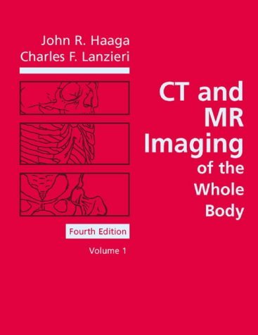 CT and MR Imaging of the Whole Body (2-Volume Set): 9780323011334 ...
