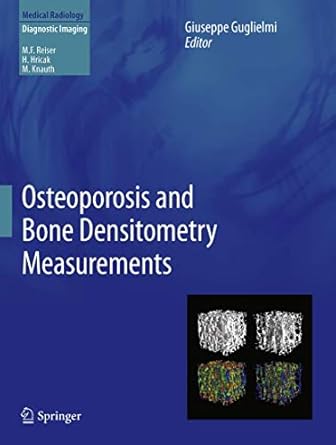 Osteoporosis and Bone Densitometry Measurements (Medical Radiology ...