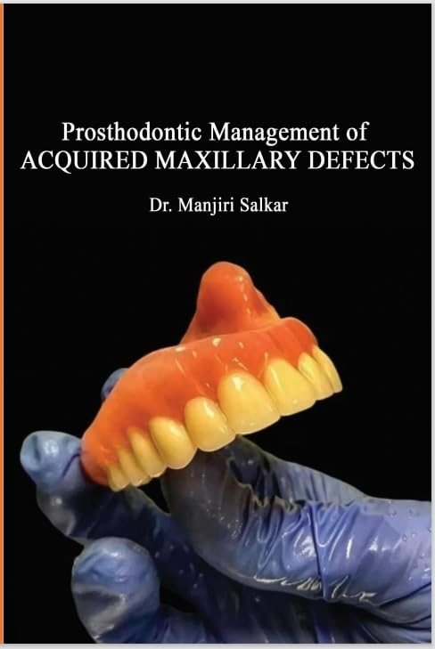 Buy PROSTHODONTIC MANAGEMENT OF ACQUIRED MAXILLARY DEFECTS Book Online ...