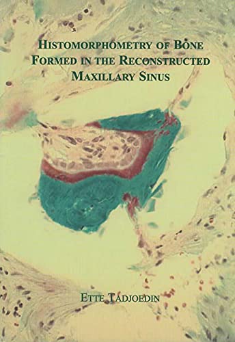 Histomorphometry of Bone Formed in the Reconstructed Maxillary Sinus ...