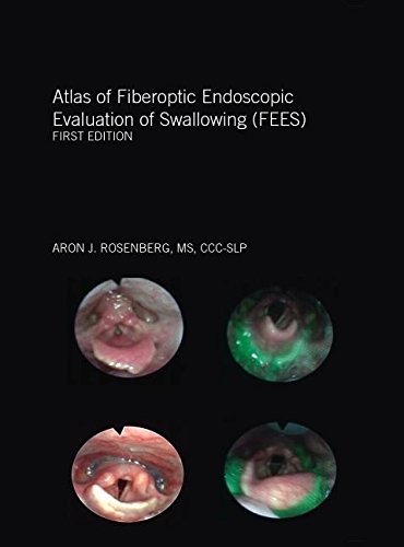 Amazon | Atlas of Fiberoptic Endoscopic Evaluation of Swallowing (Fees ...