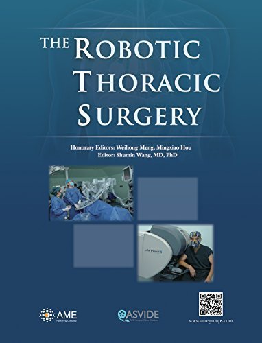 Robotic Thoracic Surgery | Amazon.com.br