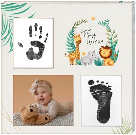 Amazon.com: Baby Milestone Book, unique design Baby Keepsake Journal ...