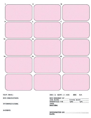 Amazon.com: #2421 ECG Mounting Sheets with Patient Information - 8.5x11 ...