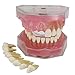 Amazon.com: Dental Implant Teeth Model Study Teach Standard Model with ...