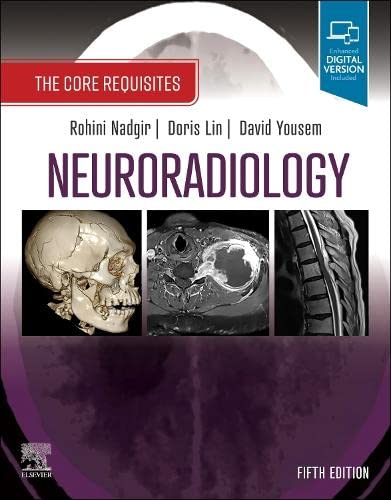 Neuroradiology: The Core Requisites: 9780323759755: Medicine & Health ...