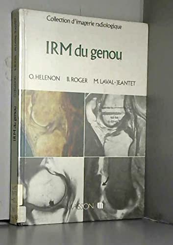 Amazon.in: Buy Irm du genou Book Online at Low Prices in India | Irm du ...