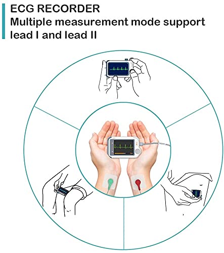 Wellue Checkme Lite SpO2 & ECG Monitor, Wireless Detection Device with ECG Tracking Function ...