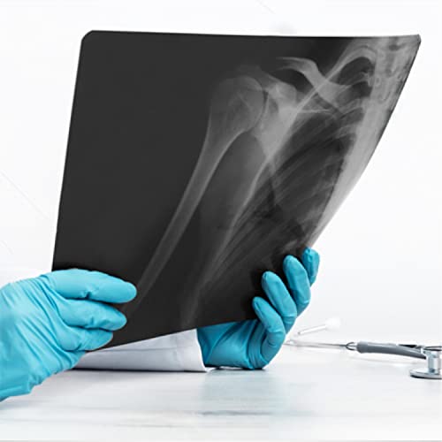 VMS HI-Speed conventional X-Ray Medical Film Blue Base Sensitive 8 inch ...