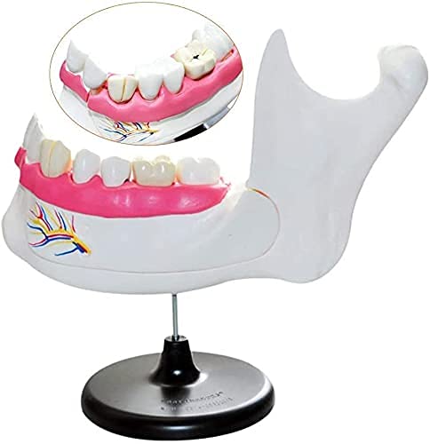 Buy WERYU Anatomy Model, Educational Dolls Dental Dentition and Molar ...