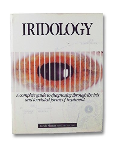 Iridology: A Complete Guide: Sharan, Farida: 9780722527788: Amazon.com ...
