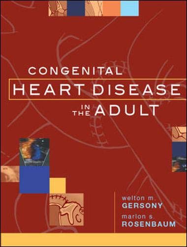 Amazon | Congenital Heart Diseases in the Adult | Gersony, Welton M., M ...