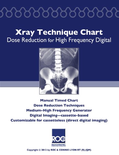 Xray Technique Chart Dose Reduction for High Frequency Digital eBook ...