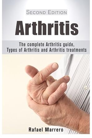 Arthritis: The Complete Arthritis Guide : Amazon.in: Books