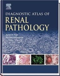 Diagnostic Atlas Of Renal Pathology: A Companion To Brenner And Rector ...