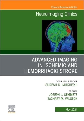 Advanced Imaging in Ischemic and Hemorrhagic Stroke, An Issue of ...