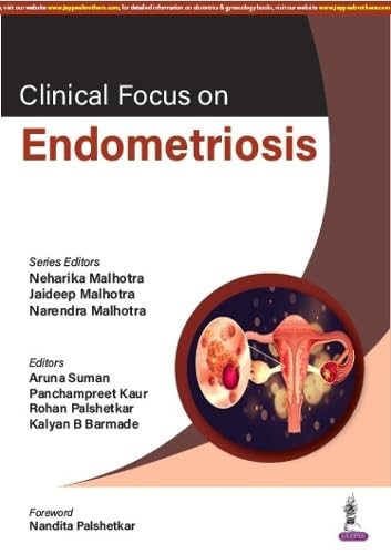 Buy Clinical Focus on Endometriosis Book Online at Low Prices in India ...