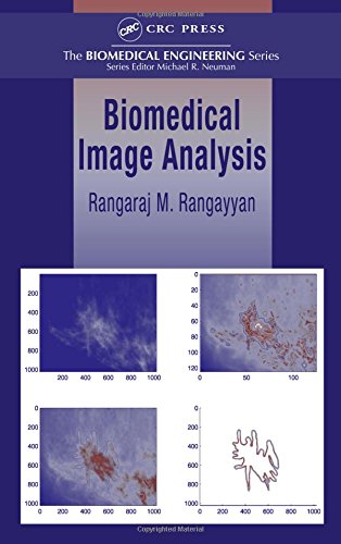 Biomedical Image Analysis (Biomedical Engineering): 9780849396953 ...