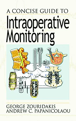 A Concise Guide to Intraoperative Monitoring: 9780849308864: Medicine ...