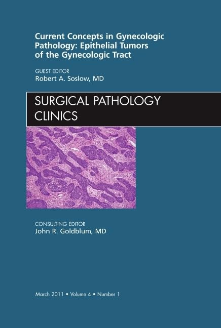 Current Concepts in Gynecologic Pathology: Epithelial Tumors of the ...