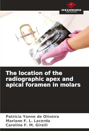 The location of the radiographic apex and apical foramen in molars: de ...