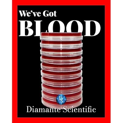 Pre-Poured Agar Plates | 15mm x 100mm Petri Plates | Chile | Ubuy
