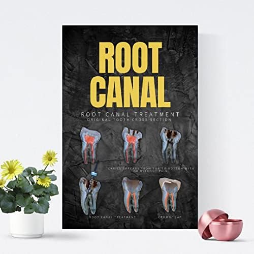 Root canal CS patient education Dental poster for dentist clinic ...