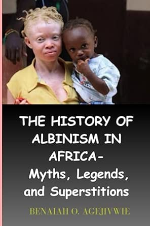Amazon.com: THE HISTORY OF ALBINISM IN AFRICA-: Myths, Legends, and ...