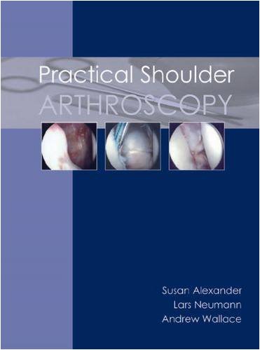 Practical Shoulder Arthroscopy: 9781903378601: Medicine & Health ...