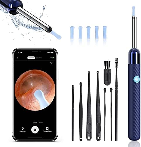 Amazon.com: Teslong Digital Otoscope, Ear Camera with Ear Wax Removal ...