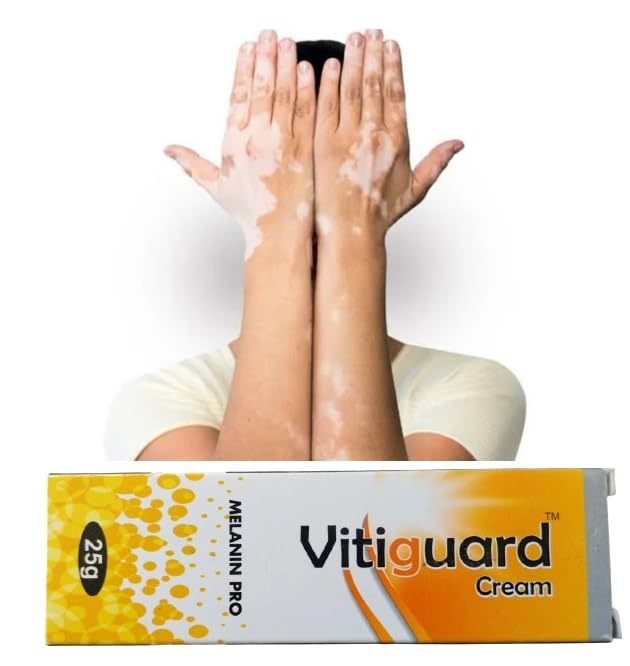 Vitiguard Vitiligo Cream 25g For White Patches Skin Discoloration Scar ...