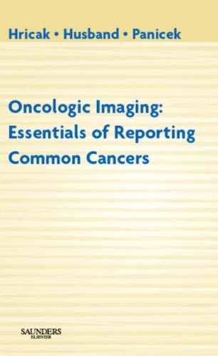 Oncologic Imaging: Essentials of Reporting Common Cancers ...