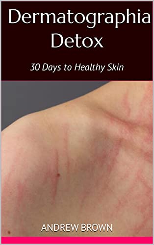 Dermatographia Detox: 30 Days to Healthy Skin - Kindle edition by Brown ...