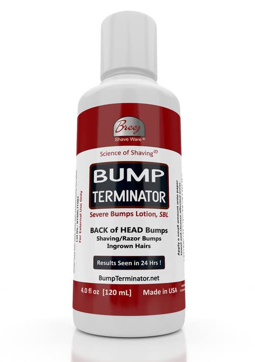 Amazon.com: Bump Terminator Severe Bumps Lotion (4oz) : Beauty ...