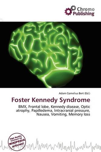Amazon.co.jp: Foster Kennedy Syndrome : 本