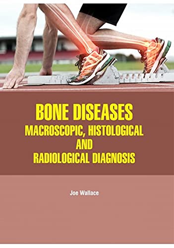 BONE DISEASES: MACROSCOPIC, HISTOLOGICAL AND RADIOLOGICAL DIAGNOSIS(HB ...
