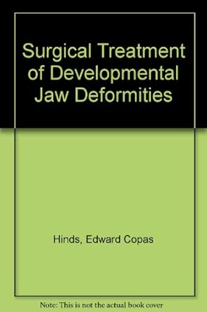 Surgical treatment of developmental jaw deformities: Hinds, Edward C ...