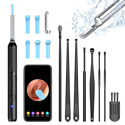 Top 10 Best Ear Wax Removal System : Reviews & Buying Guide - Katynel