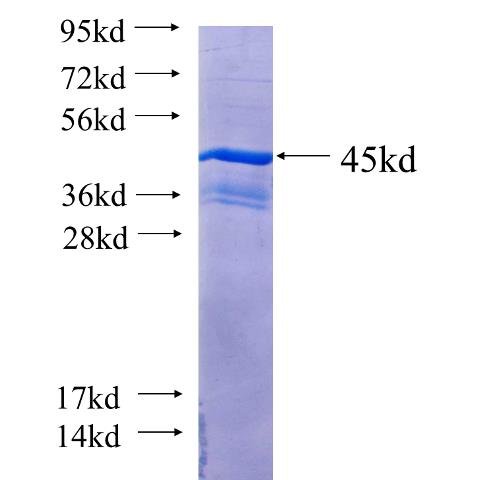 Amazon.com: Human PDCD2 Fusion Protein : Industrial & Scientific